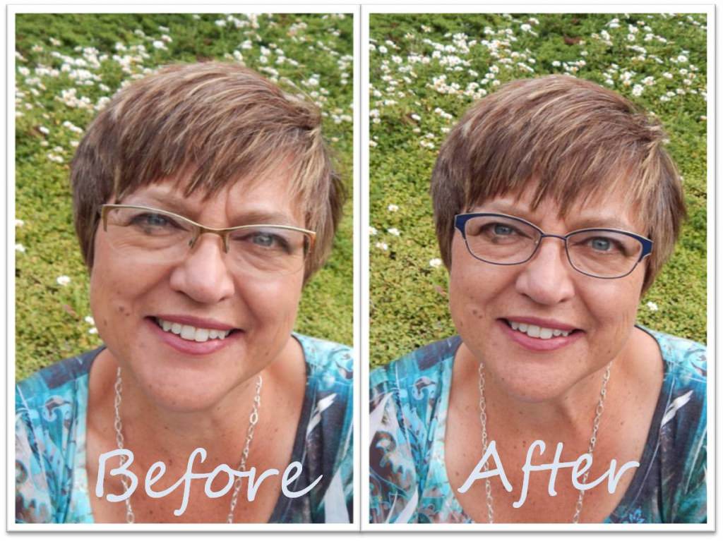 Glasses Makeover | Eyewear Transformation | Patient Testimonial